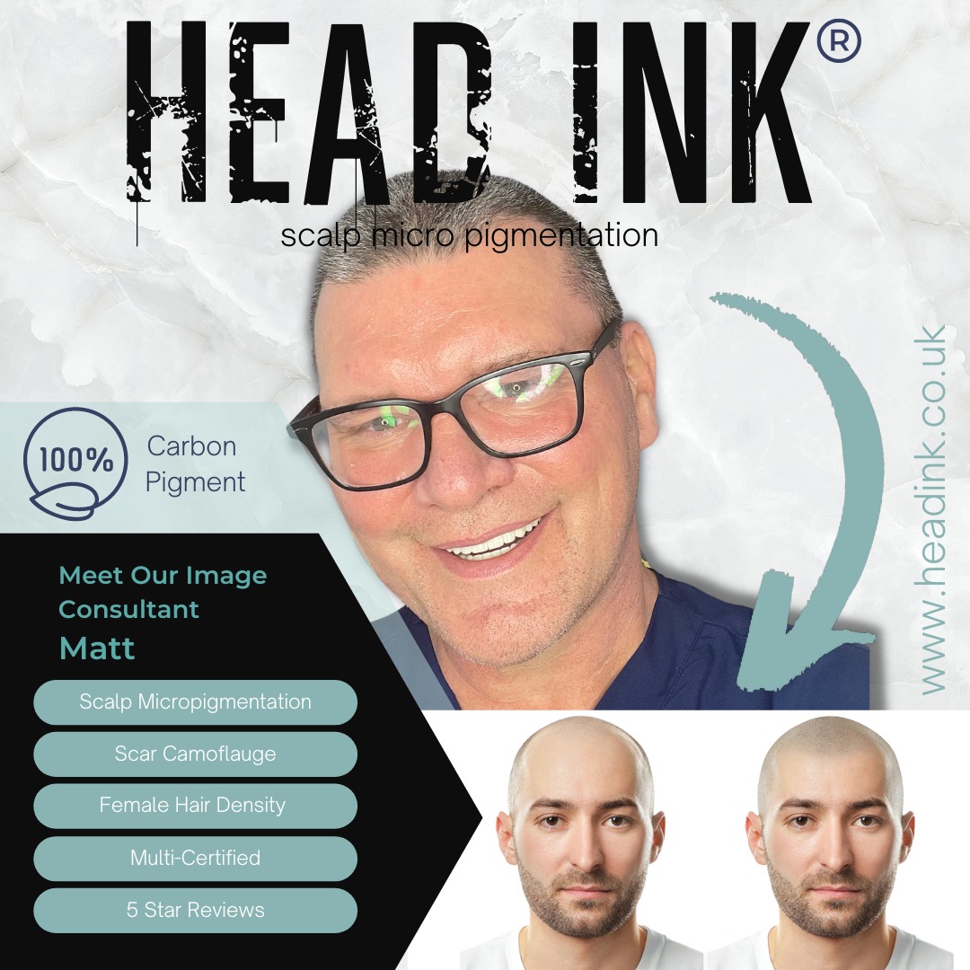 AN EXCITING NEW HAIR LOSS SOLUTION CALLED SMP.